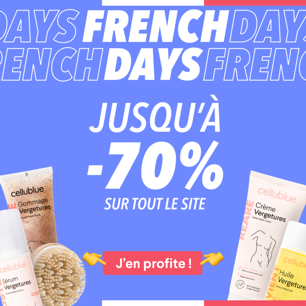 Vergeture de croissance à l'adolescence : causes & solutions - Cellublue