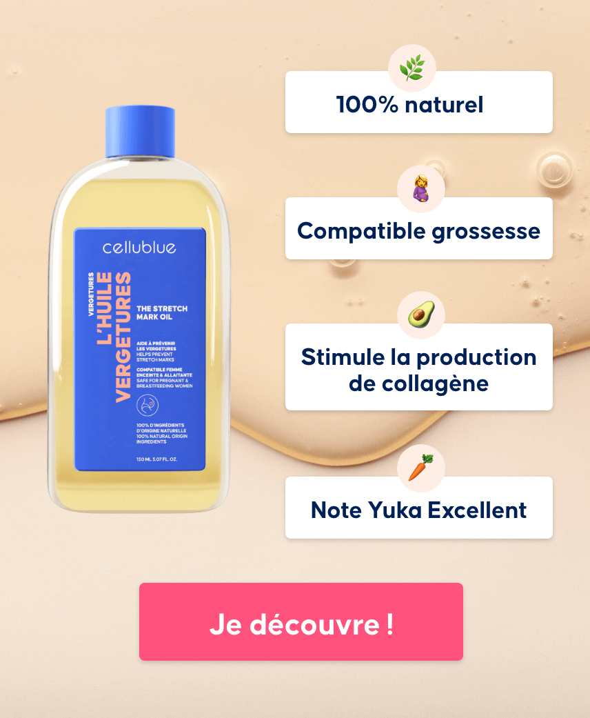 Vergetures sur les hanches : comment les prévenir et les atténuer ...